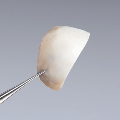 OptiGraft Sterile Cornea (Whole Moon, Full Thickness With Scleral Rim ...